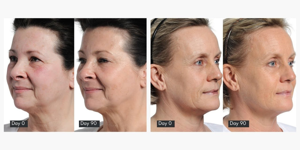 Expert Tips for Removing Dry, Flaky Skin From Your Face