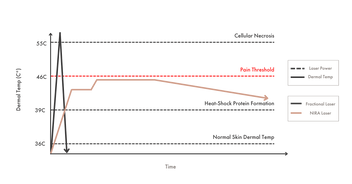 The Difference Between NIRA Pro and NIRA Precision Lasers